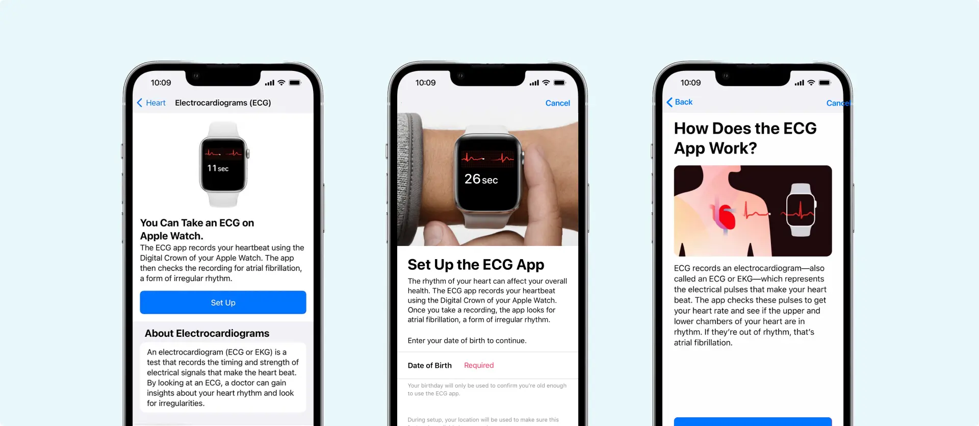 How to Install the ECG App on Your Apple Watch | Qaly